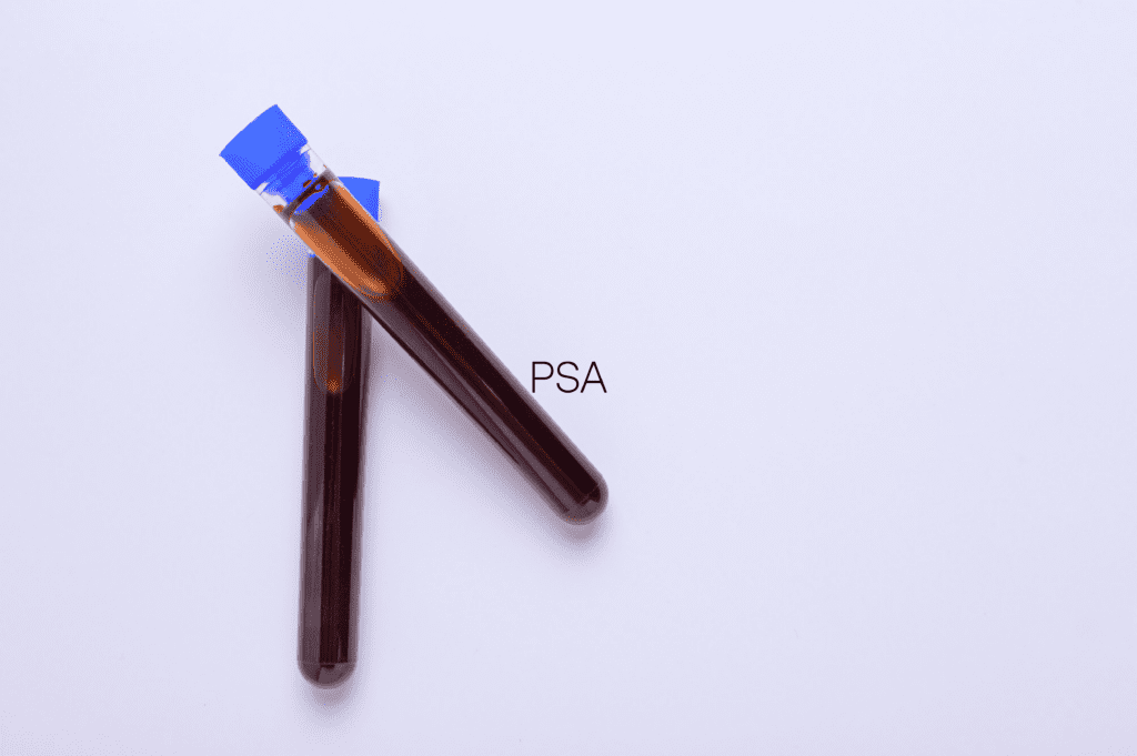 PSA LABWORK | Peter MD